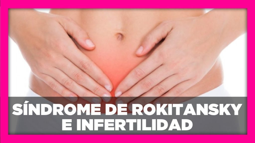 Cómo manejar el síndrome de Rokitansky | SoloSalud.net
